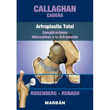 Callaghan Cadera 3. Artroplastia Total. Complicaciones. Alternativas a ...