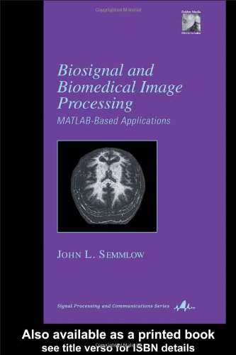 Buy Biosignal and Medical Image Processing (Signal Processing and ...