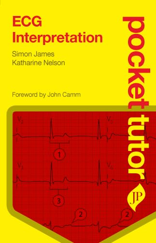 Buy (OLD)ECG INTERPRETATION POCKET TUTOR Book Online at Low Prices in ...