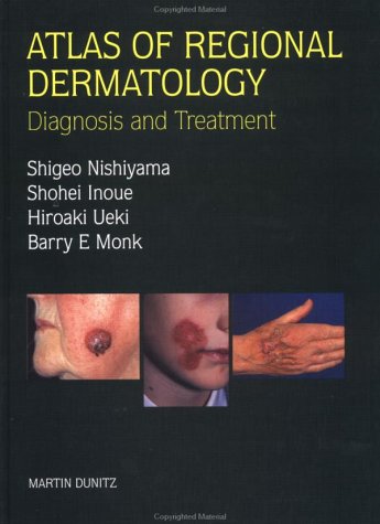 Atlas of Regional Dermatology: Diagnosis & Treatment: 9781853174100 ...