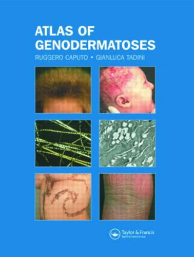 Atlas of Genodermatoses: 9781841842516: Medicine & Health Science Books ...