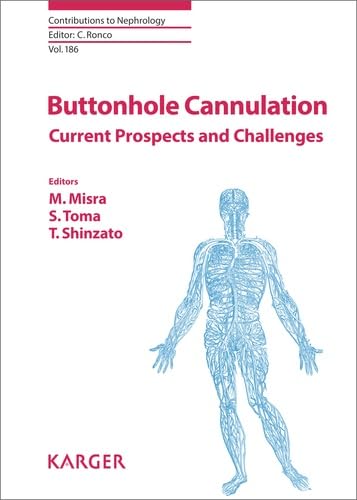 Buttonhole Cannulation: Current Prospects and Challenges ...