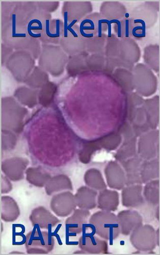 Amazon.com: Leukemia (WHAT YOU NEED TO KNOW Book 7) eBook : T., BAKER ...