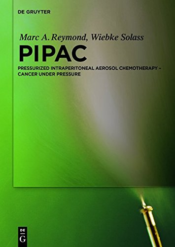 PIPAC: Pressurized Intraperitoneal Aerosol Chemotherapy - Cancer Under ...
