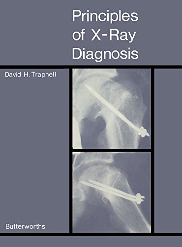 Amazon | Principles of X-Ray Diagnosis (English Edition) [Kindle ...