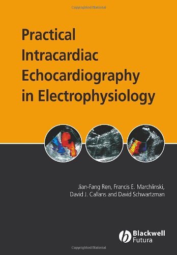 Amazon.com: Practical Intracardiac Echocardiography in Electrophysiology eBook : Ren, Jian-Fang ...