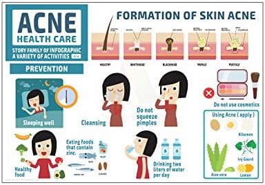 Anne Print Solutions® Formation of skin acne chart Posters For Hospital ...