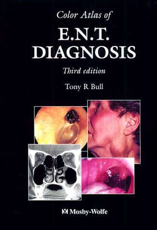 Color Atlas of Ent Diagnosis: Bull, T. R.: 9780723422716: Amazon.com: Books