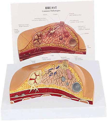 Buy Model of Lesion Anatomical Model of Medical Model Medical Model of ...