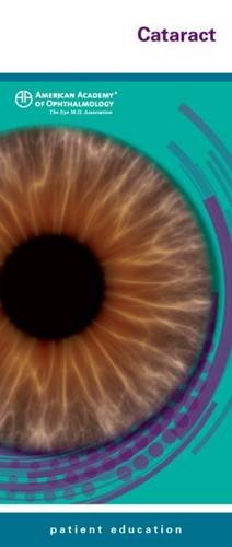 Cataract: 9781615254934: Amazon.com: Books