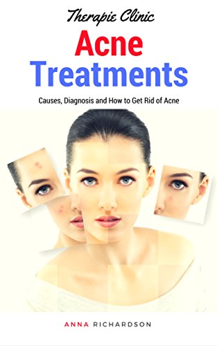 Acne Treatments: Causes, Diagnosis and How to Get Rid of Acne eBook ...
