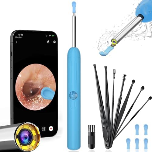 Amazon.com: Ear Wax Removal, Ear Cleaner with Camera with 1080P, Ear ...