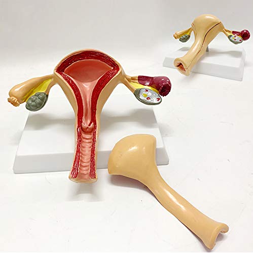 Ovarian Uterus Model Anatomical Model Of Human Healthy Uterus Female ...