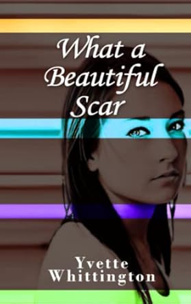 What a Beautiful Scar: Whittington, Yvette: 9781954058286: Amazon.com ...