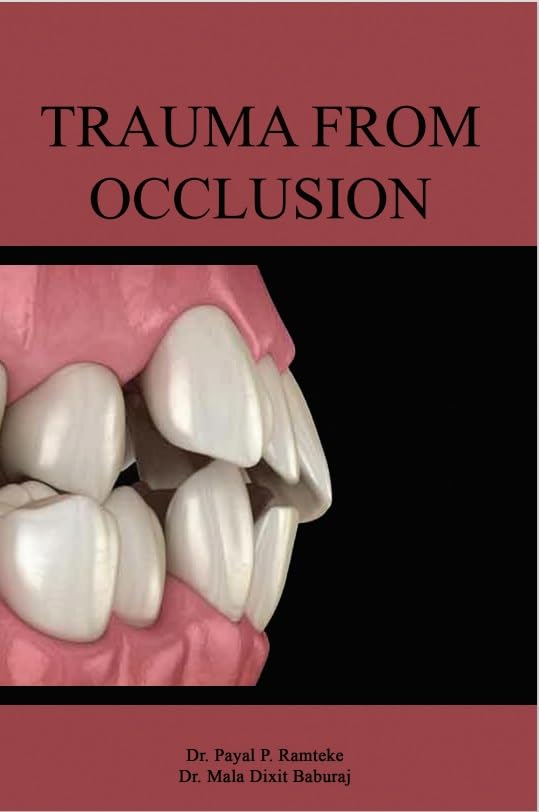 Buy Trauma from Occlusion Book Online at Low Prices in India | Trauma ...