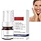 Aobenz Serum, Aobenz Spot Remover Serum, Aobenz Whitening and Freckle ...