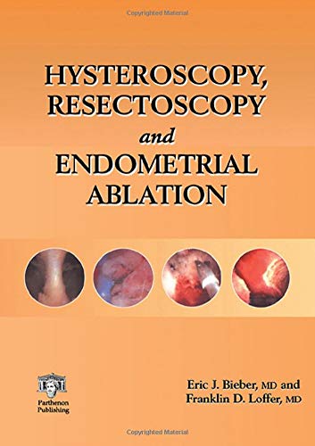 Hysteroscopy, Resectoscopy and Endometrial Ablation: 9781842141175 ...