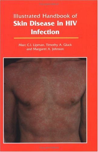 Illustrated Handbook of Skin Disease in HIV Infection: Lipman, M.C.I ...