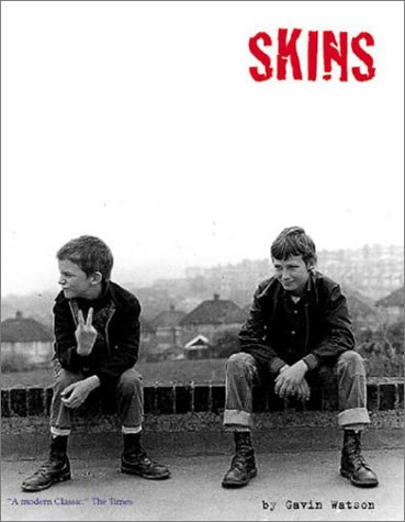 Amazon.com: Skins: 9781587540165: Watson, Gavin: Books