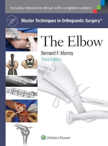 MASTER TECHNIQUES IN ORTHOPAEDIC SURGERY: THE ELBOW : MORREY, MORREY ...