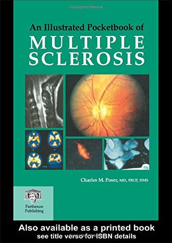 An Illustrated Pocketbook of Multiple Sclerosis: 9781842141410 ...