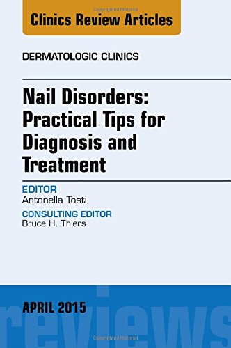 Nail Disorders: Practical Tips for Diagnosis and Treatment, An Issue of ...