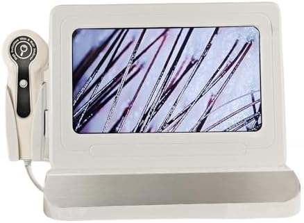 Amazon.com : Professional Scalp Camera with 11-Inch HD Screen - High ...