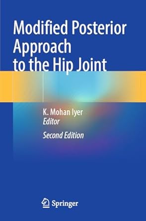 Modified Posterior Approach to the Hip Joint: 9783031357923: Medicine ...