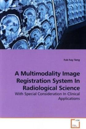 A Multimodality Image Registration System In Radiological Science: With ...