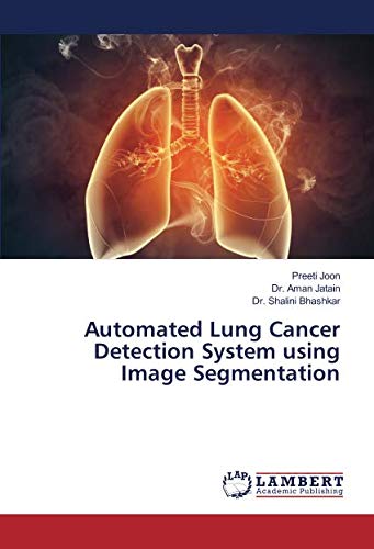 Buy Automated Lung Cancer Detection System Using Image Segmentation