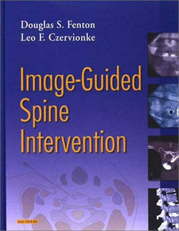 By Douglas S. Fenton - Image-Guided Spine Intervention: 1st (first ...
