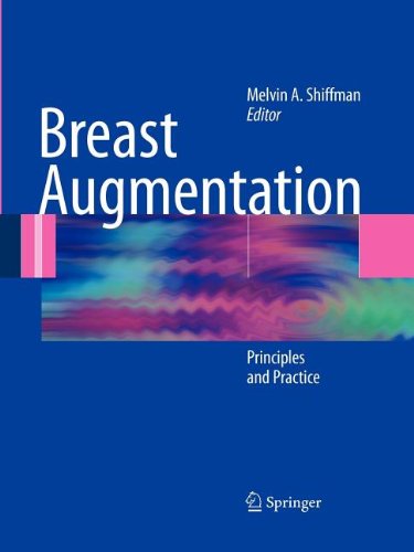 Breast Augmentation: Principles and Practice: 9783540871613: Medicine ...