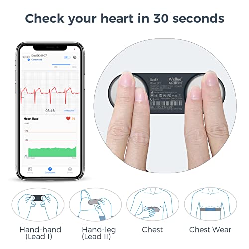 ECG Portatile Elettrocardiogramma ViATOM Monitor - ConsiglioPro.it