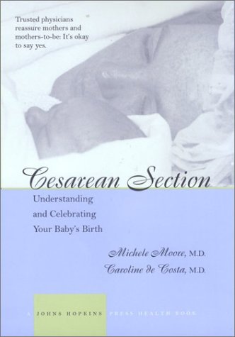 Cesarean Section: Understanding and Celebrating Your Baby's Birth (A ...
