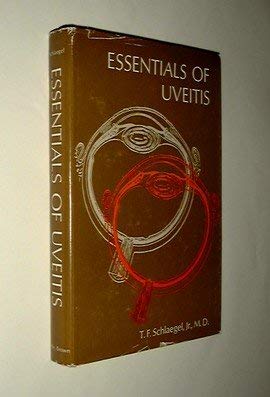 Essentials of Uveitis: 9780700001606: Books - Amazon.ca
