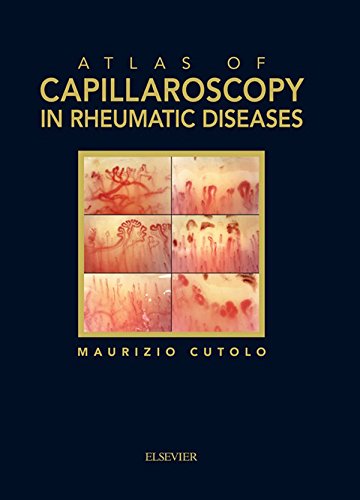 Amazon.com: Atlas of capillaroscopy in rheumatic diseases eBook ...