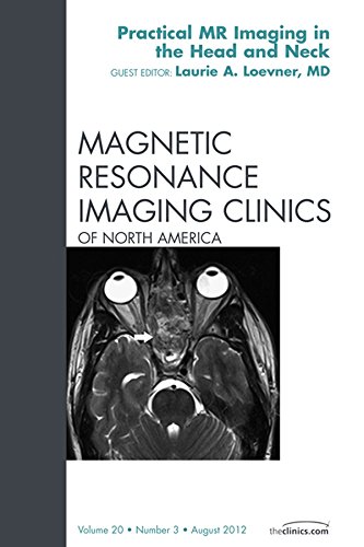 Amazon.com: Head and Neck MRI, An Issue of Magnetic Resonance Imaging ...