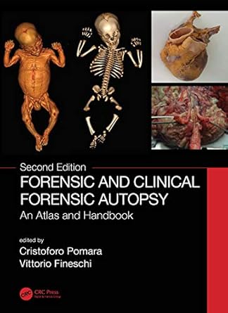 Forensic and Clinical Forensic Autopsy: An Atlas and Handbook ...