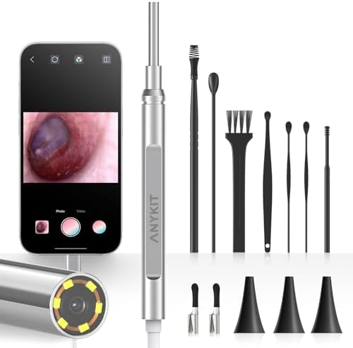 Amazon.com: Anykit Ear Wax Removal Camera, Ultra Clear View Ear Cleaner ...