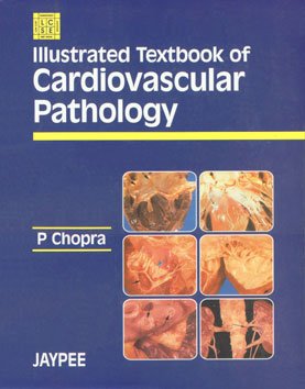Buy Illustrated Textbook of Cardiovascular Pathology Book Online at Low ...
