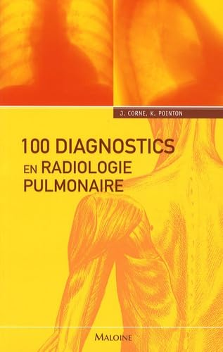 100 diagnostics en radiologie pulmonaire : Corne, Jonathan, Pointon ...