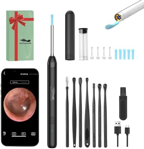 Amazon.com: Ear Wax Removal Tool, Wireless WiFi Ear Cleaner with 1296P ...