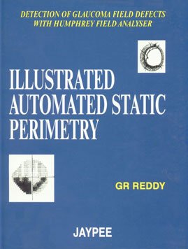 Illustrated Automated Static Perimetry : Amazon.in: Books