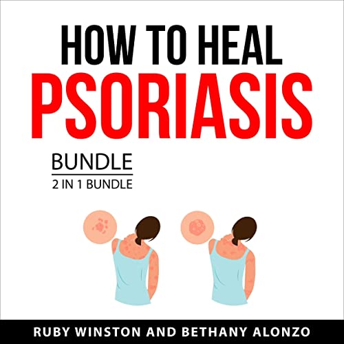 How to Heal Psoriasis Bundle, 2 in 1 Bundle: Healing Psoriasis ...