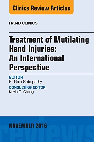 Amazon.com: Treatment of Mutilating Hand Injuries: An International ...