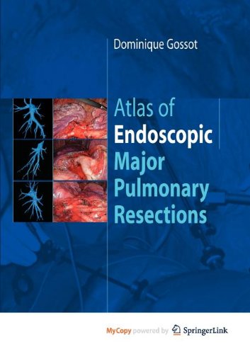 Amazon.co.jp: Atlas of endoscopic major pulmonary resections : 本