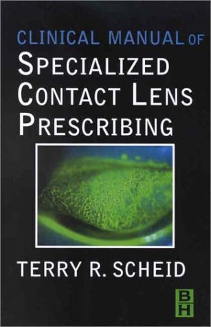 Buy Clinical Manual of Specialized Contact Lens Fitting Book Online at ...