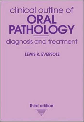 Clinical Outline of Oral Pathology: Diagnosis and Treatment ...