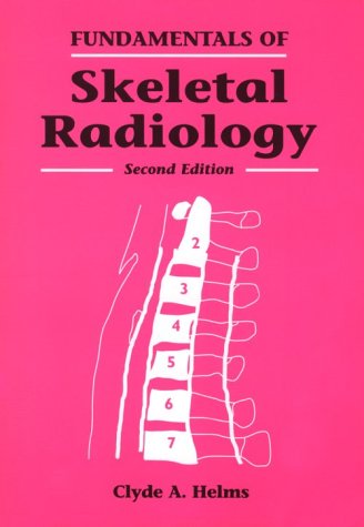 Amazon | Fundamentals of Skeletal Radiology | Helms, Clyde A. | Radiology