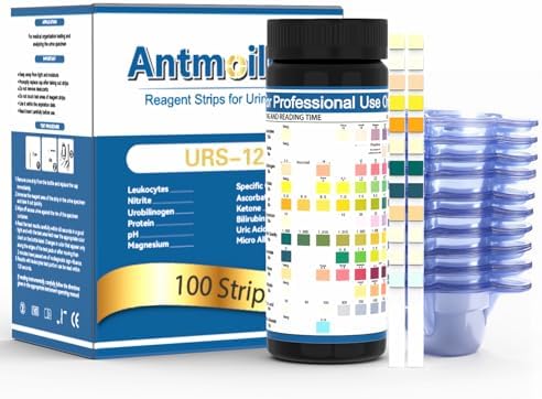 Amazon.com: Antmoilios 12-Panel UTI Test Strips Kits for Urinalysis ...
